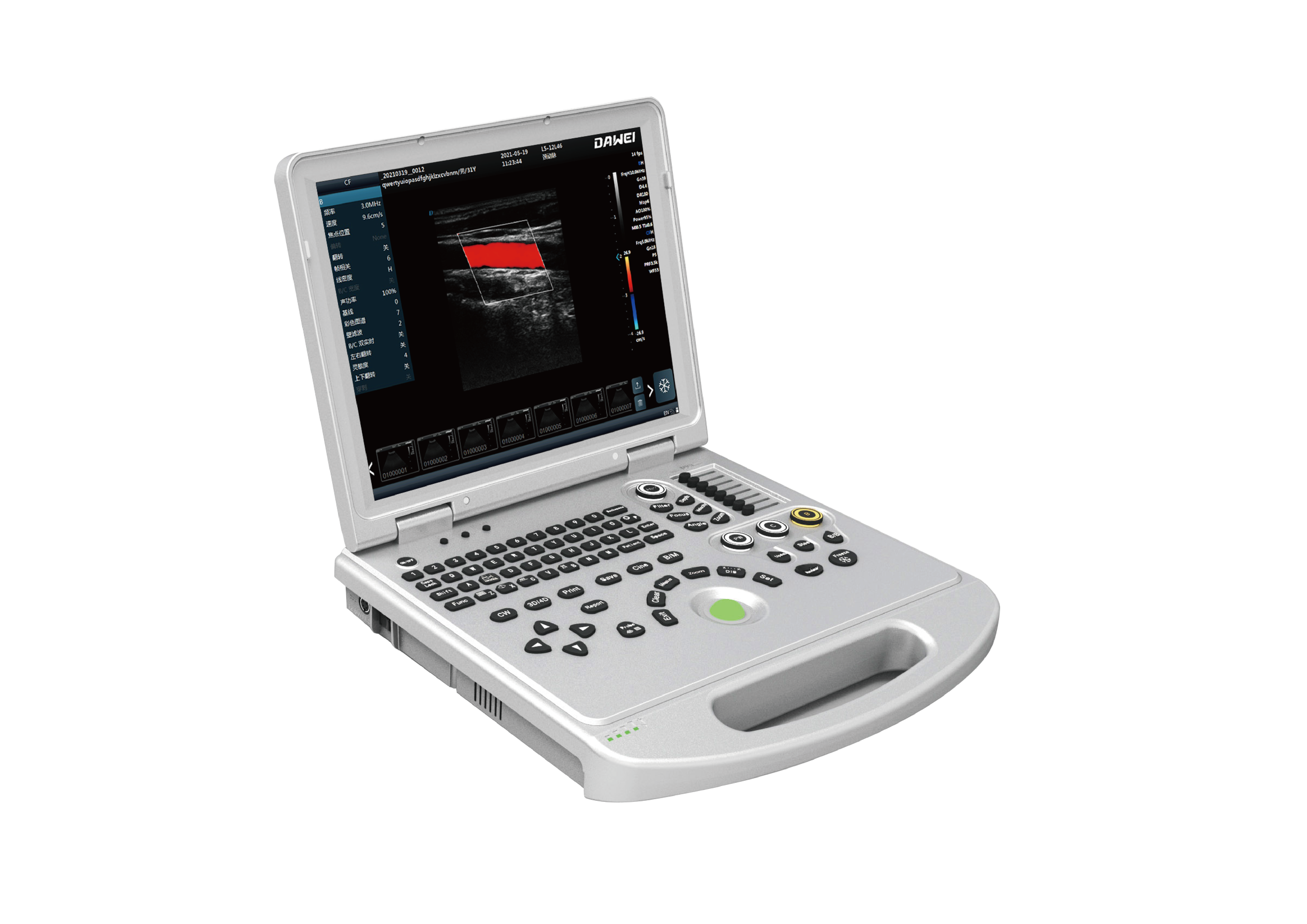 DW-L5(DW-PF522) color doppler ultrasound machine – TecAfrica Solutions