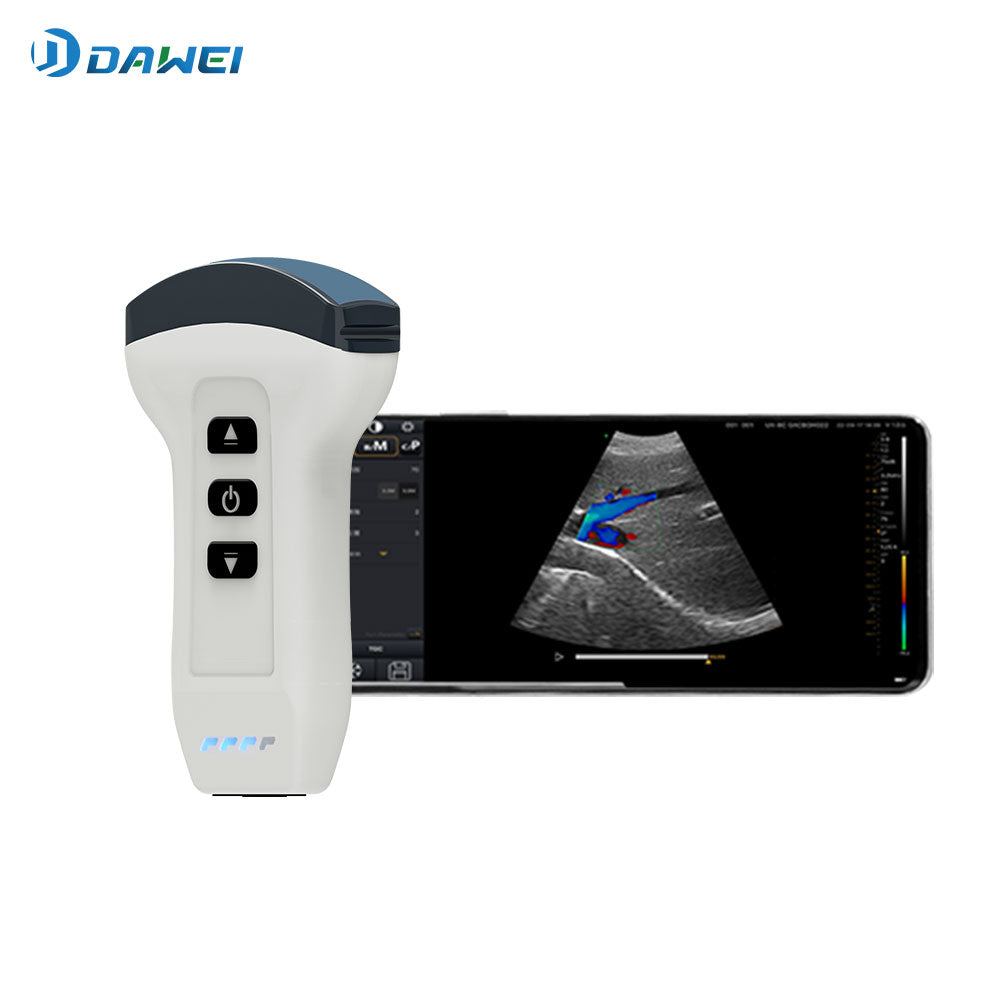 Wireless Handheld Ultrasound Scanner – TecAfrica Solutions